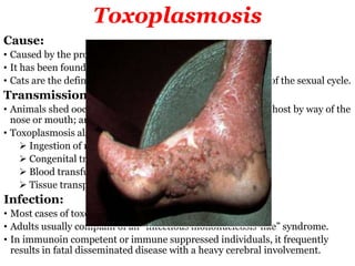 Human contact diseases | PPTX