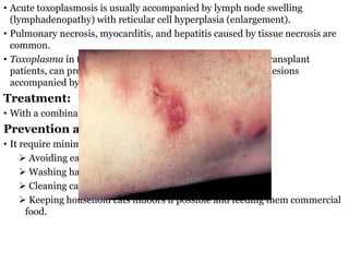 Human contact diseases | PPTX