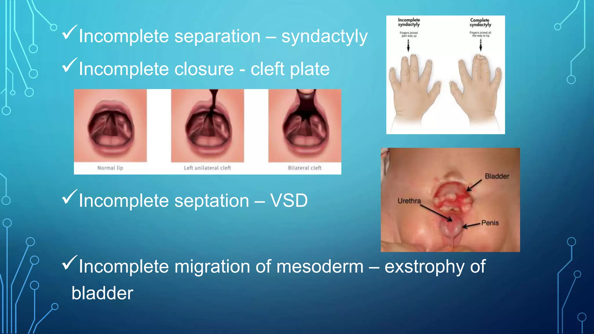 Human dysmorphism introduction | PPTX