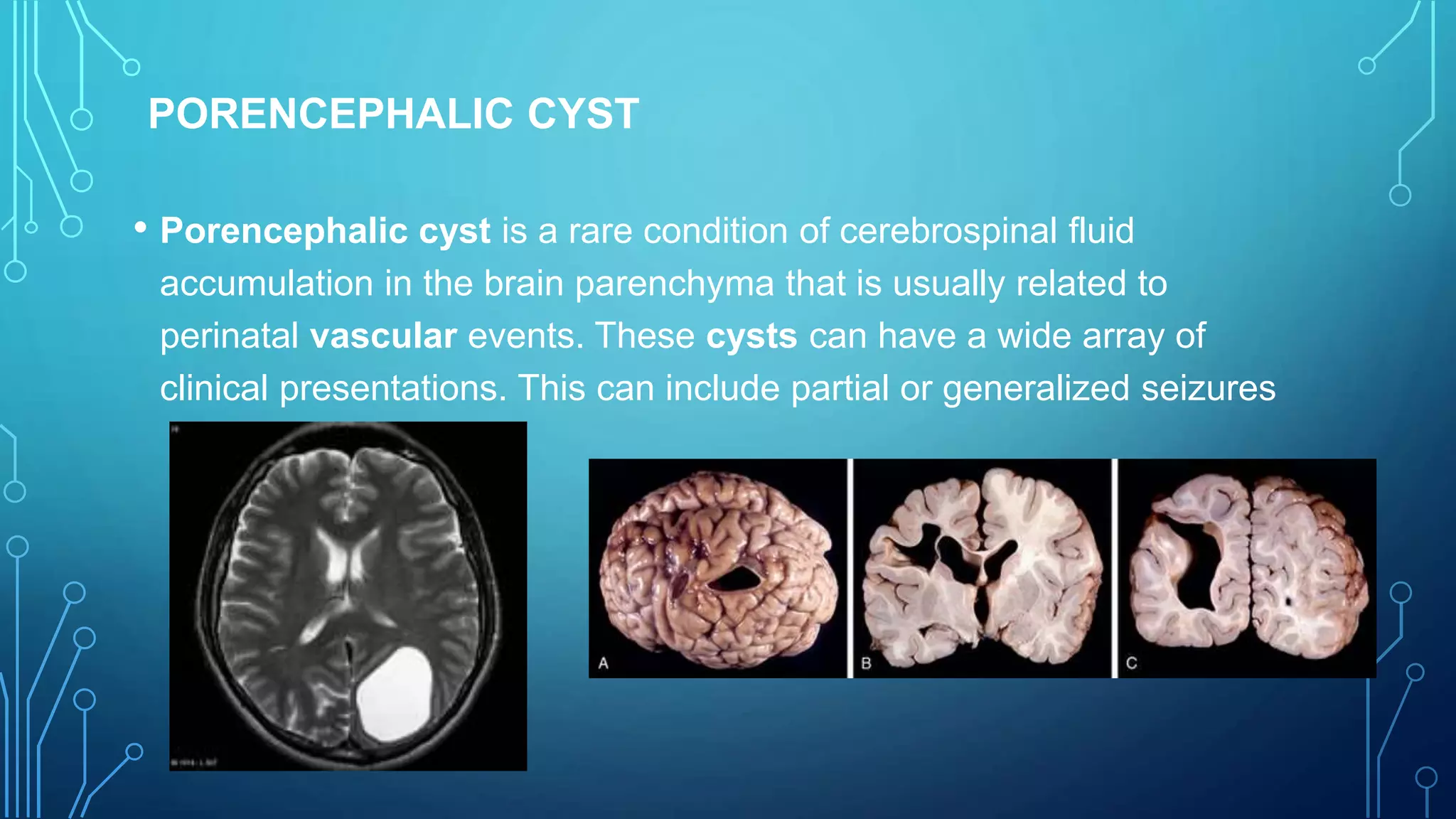 Human dysmorphism introduction | PPTX
