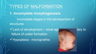 Human dysmorphism introduction | PPTX