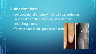 Human dysmorphism introduction | PPTX
