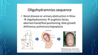 Human dysmorphism introduction | PPTX