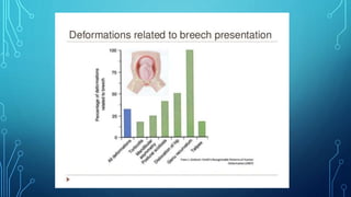 Human dysmorphism introduction | PPTX