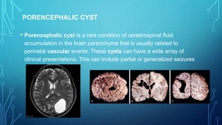 Human dysmorphism introduction | PPTX
