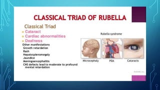 Human dysmorphism introduction | PPTX