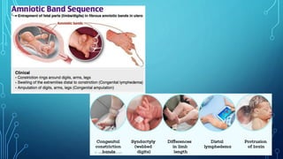 Human dysmorphism introduction | PPTX