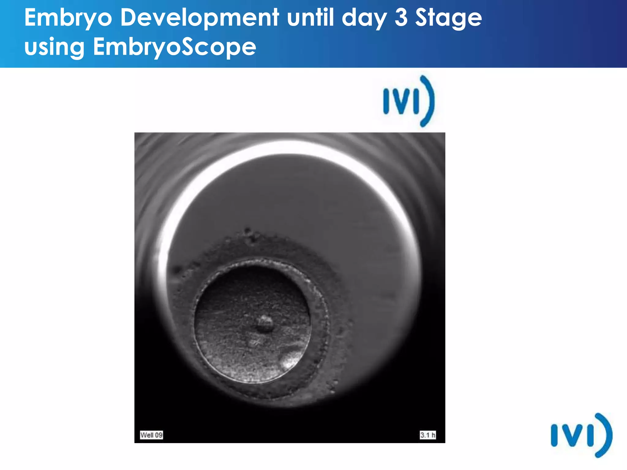 Human embryo transfer11 | PDF