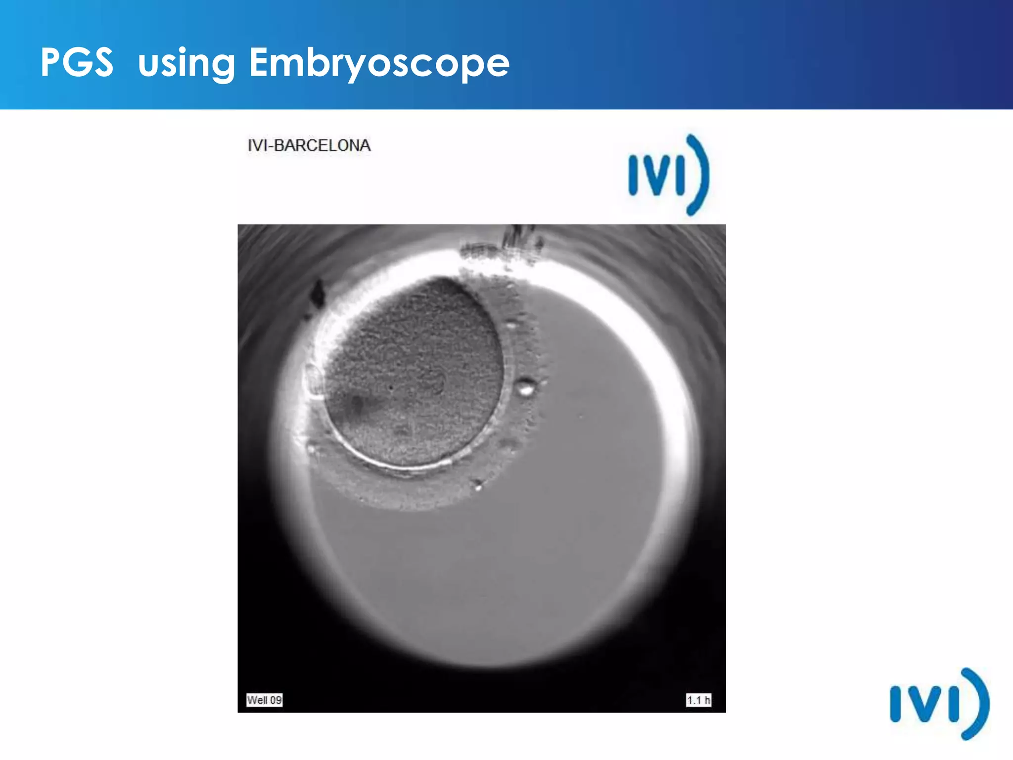 Human embryo transfer11 | PDF