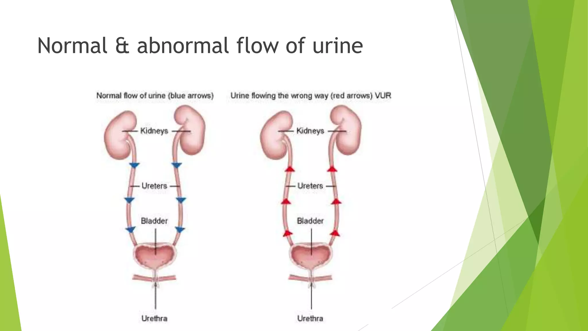 Human urinary excretory system | PPT