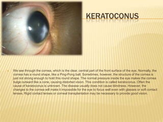 EYE basics | PPTX | Eye and Vision Conditions | Diseases and Conditions