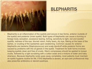 EYE basics | PPTX | Eye and Vision Conditions | Diseases and Conditions