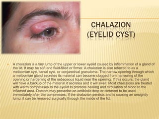 EYE basics | PPTX