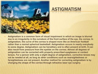 EYE basics | PPTX | Eye and Vision Conditions | Diseases and Conditions