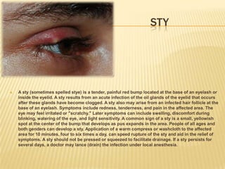 EYE basics | PPTX | Eye and Vision Conditions | Diseases and Conditions