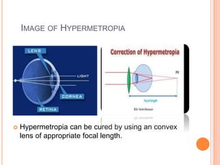 Human eye care and defects | PPTX