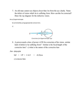 CLASS X SCIENCE STUDY MATERIAL | PDF