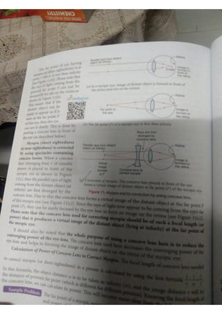 HUMAN EYe pdf ppt class 10 usefull for boards | PDF