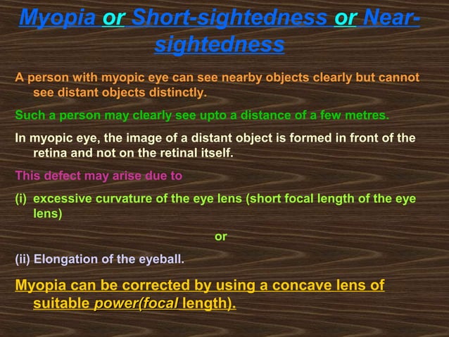Human eye class 10 | PPT | Eye and Vision Conditions | Diseases and ...