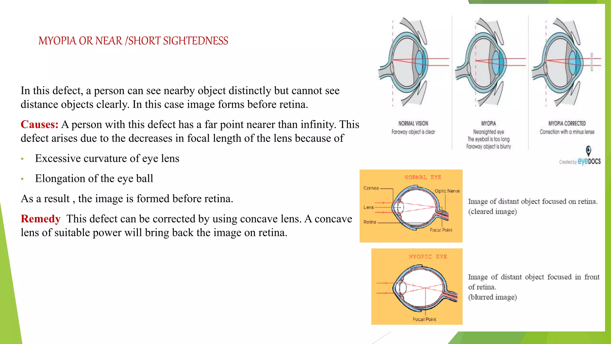 Human eye and colourful world | PPTX