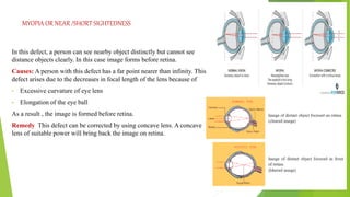 Human eye and colourful world | PPTX