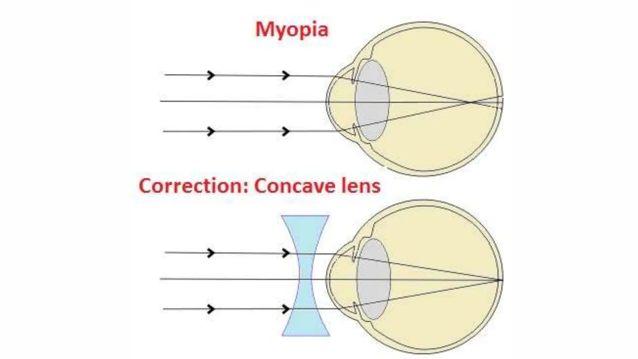 Human eye and colourful world class 10 .pptx | Eye and Vision ...