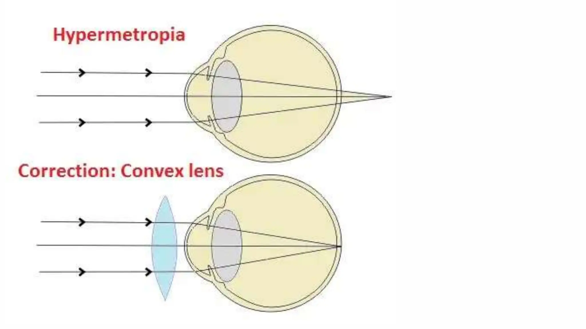 Human eye and colourful world class 10 .pptx | Eye and Vision ...