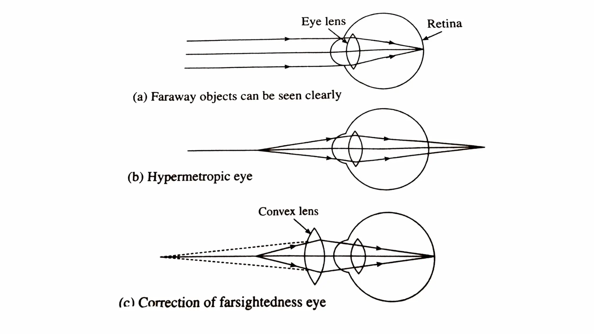 Human eye and colourful world class 10 .pptx | Eye and Vision ...