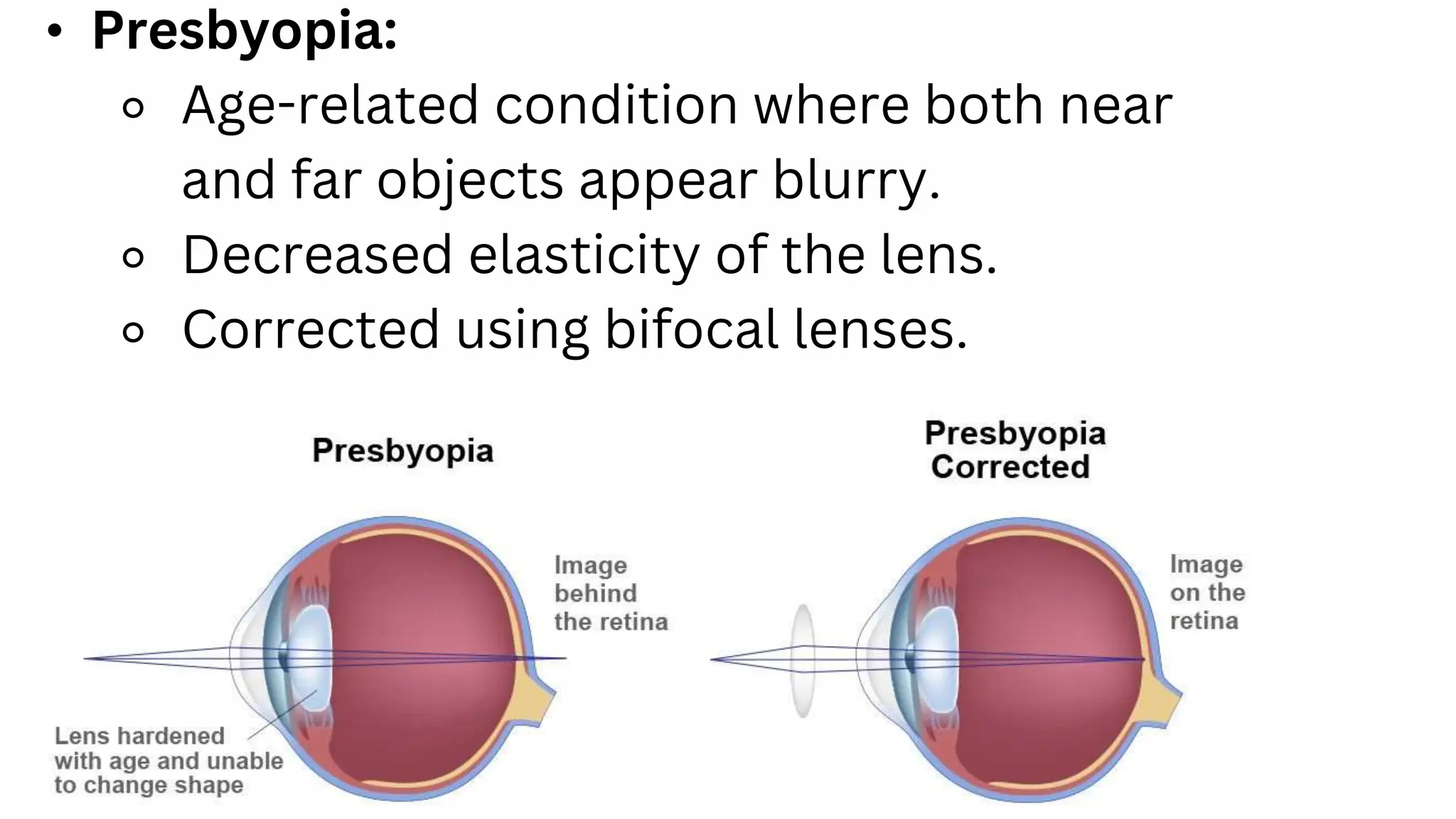 Human eye and colourful world class 10 .pptx | Eye and Vision ...