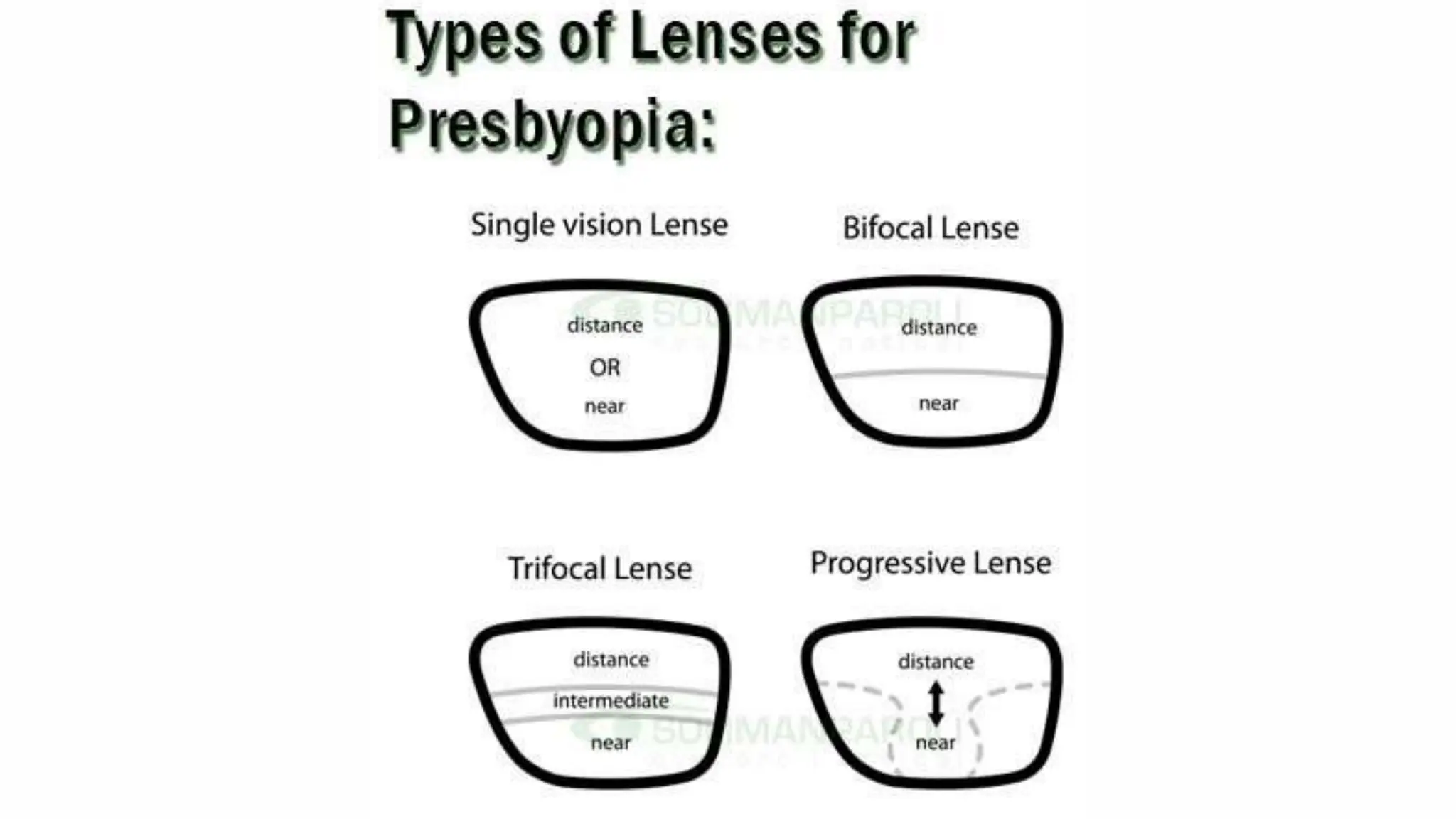 Human eye and colourful world class 10 .pptx | Eye and Vision ...
