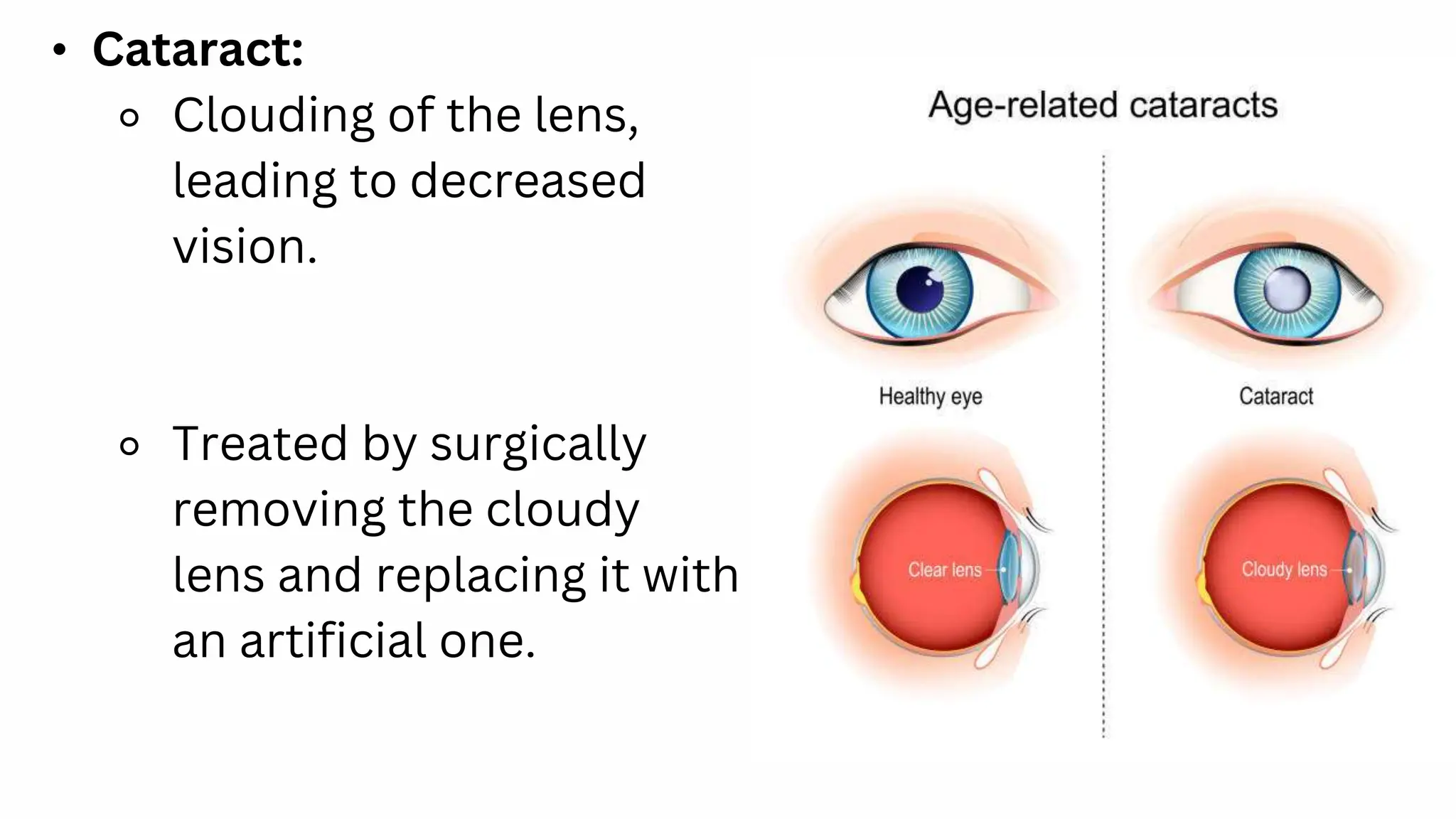 Human eye and colourful world class 10 .pptx | Eye and Vision ...