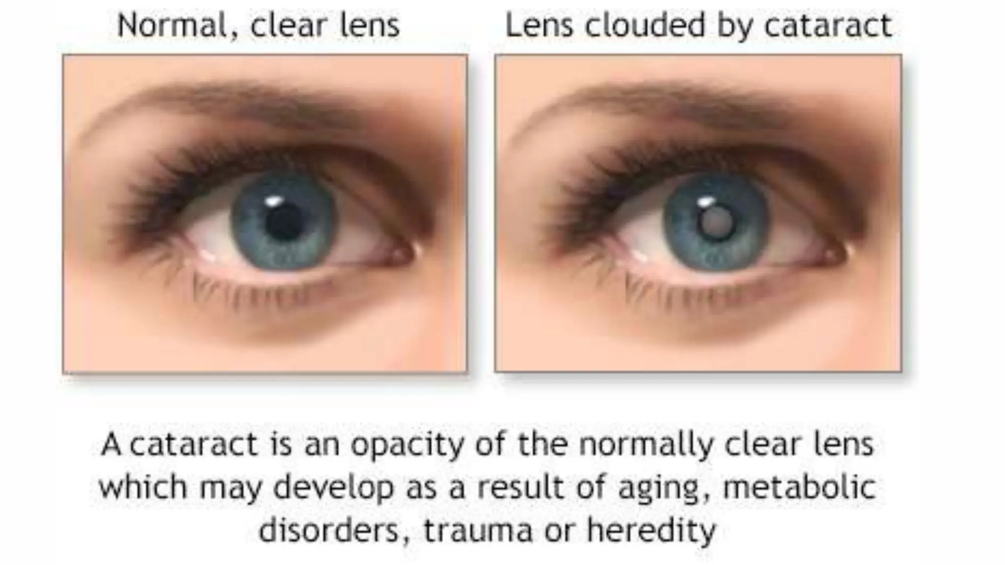 Human eye and colourful world class 10 .pptx | Eye and Vision ...