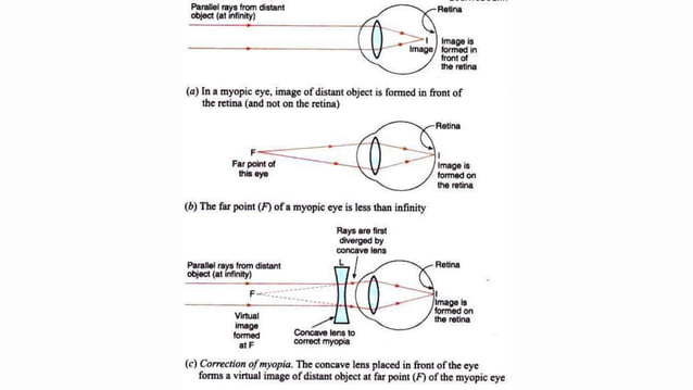 Human eye and colourful world class 10 .pptx | Eye and Vision ...