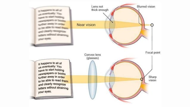 Human eye and colourful world class 10 .pptx | Eye and Vision ...