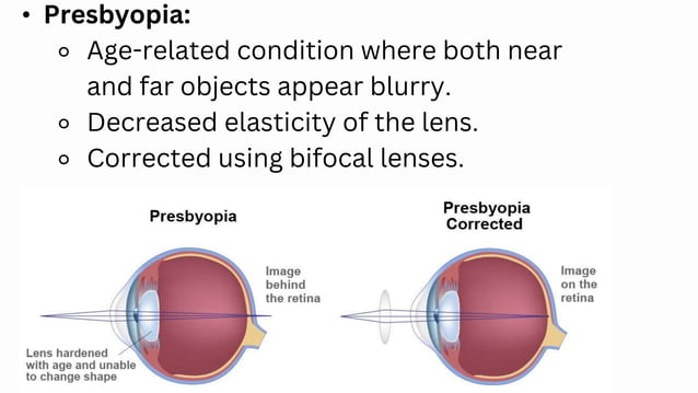 Human eye and colourful world class 10 .pptx | Eye and Vision ...