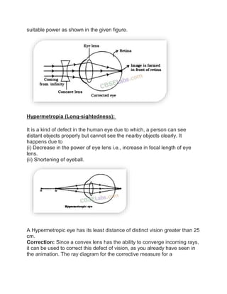 Human Eye and the Colorful world notes.docx | Eye and Vision Conditions ...