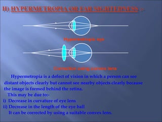 humaneyeandthecolourfulworld.ppt