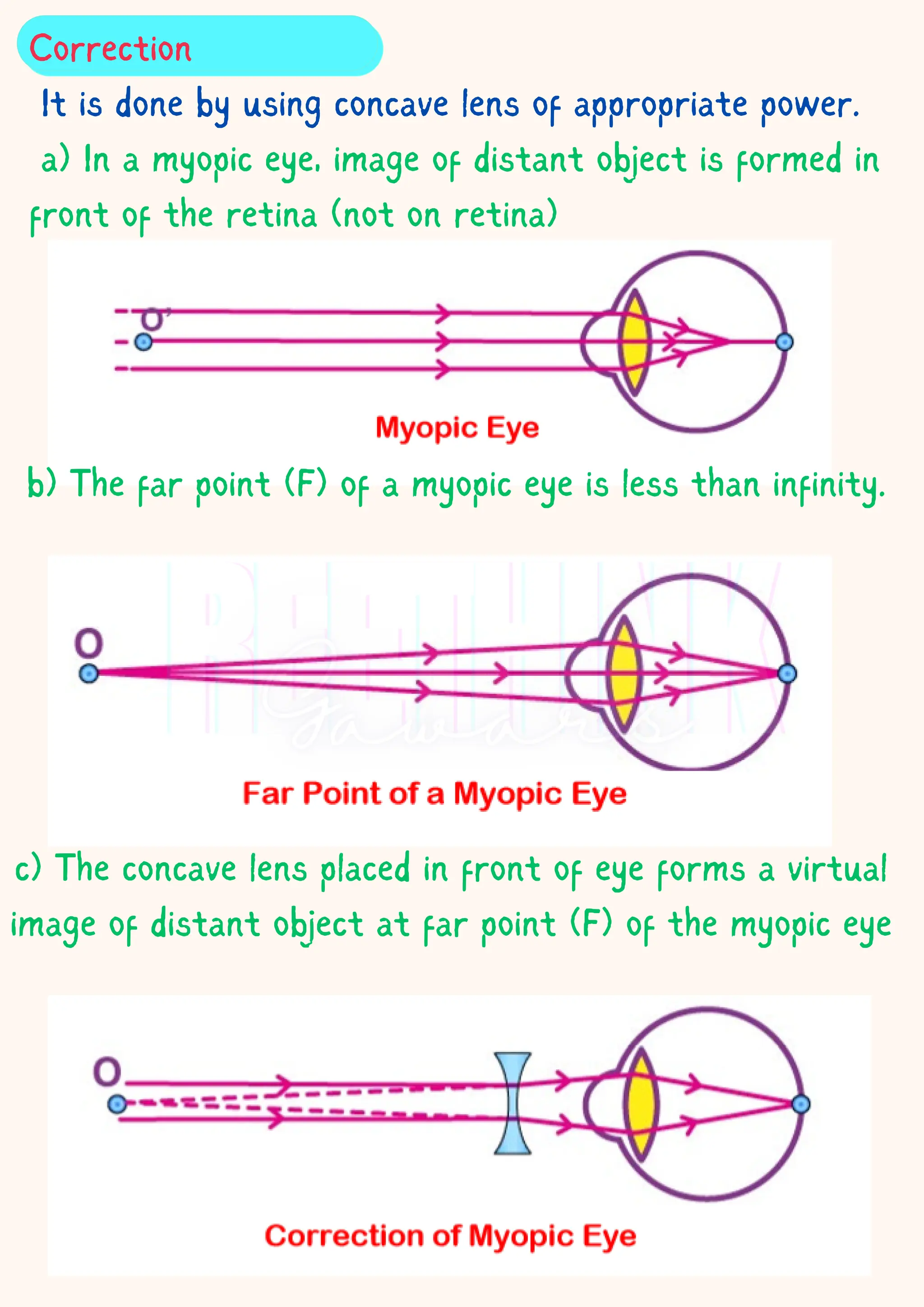 HUMAN EYE By-R.M Class 10 phy best digital notes.pdf