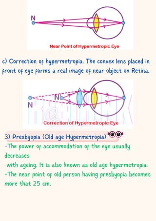 HUMAN EYE By-R.M Class 10 phy best digital notes.pdf