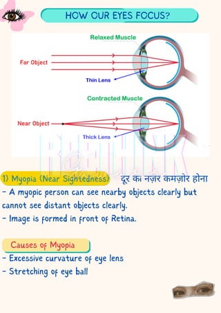 HUMAN EYE By-R.M Class 10 phy best digital notes.pdf