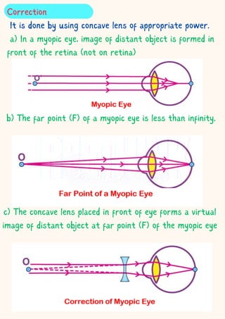 HUMAN EYE By-R.M Class 10 phy best digital notes.pdf
