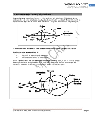 Human eye class 10 | DOCX