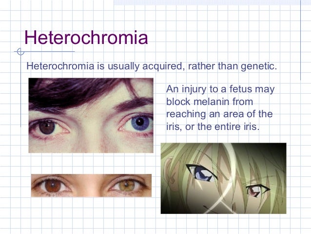 Human eye color inheritance, Mr. Wright