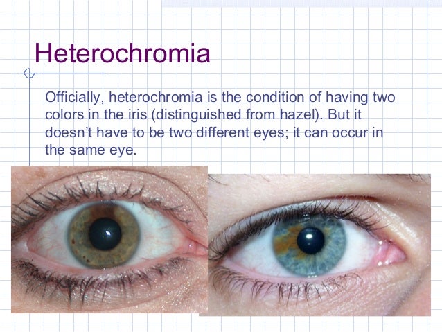 Human eye color inheritance, Mr. Wright