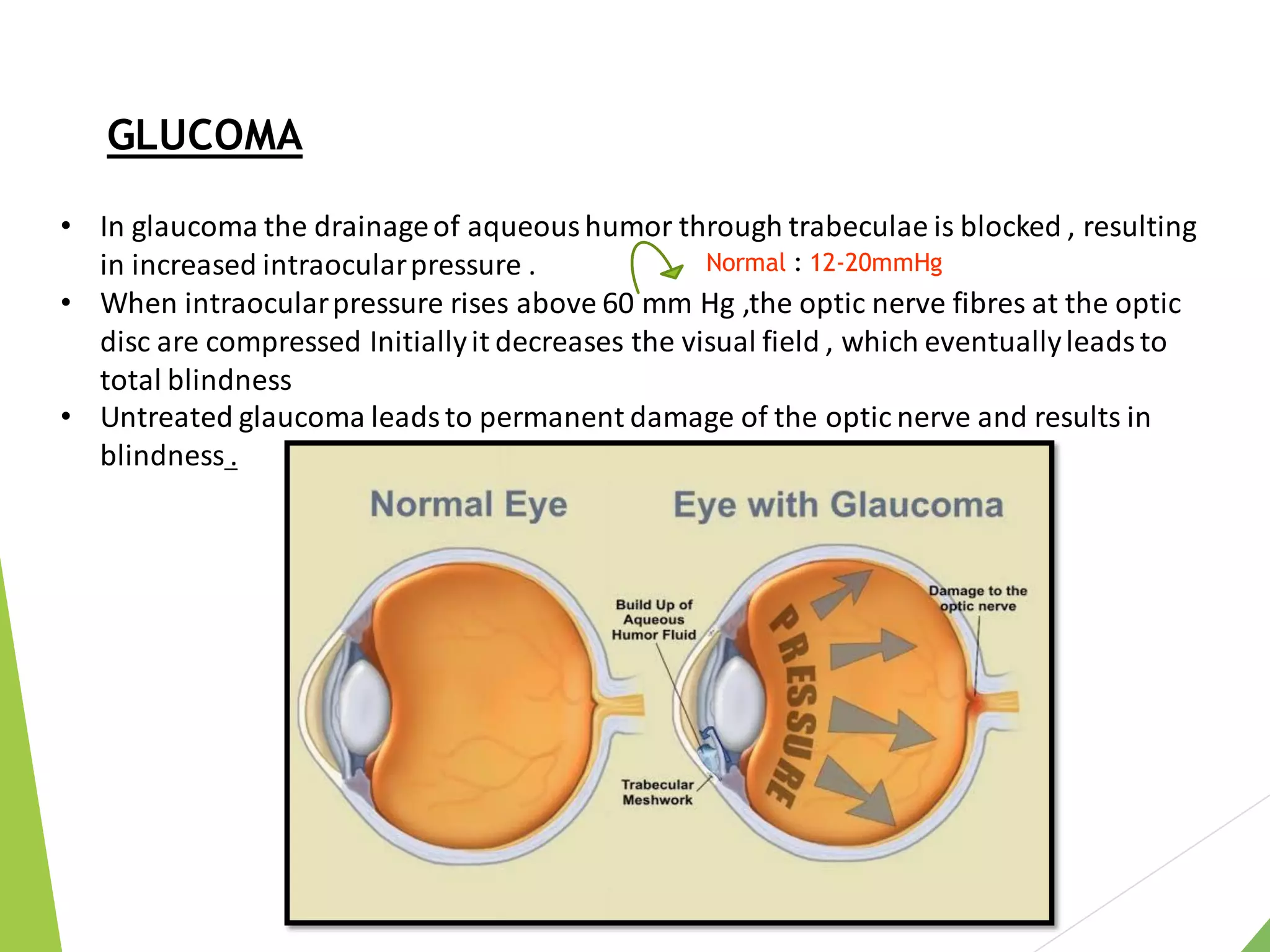 Human Eye Presentation.pdf