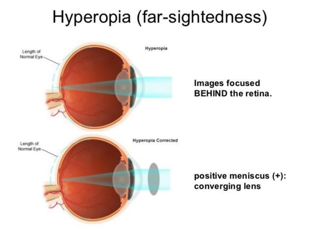Human Eye Presentation.pdf