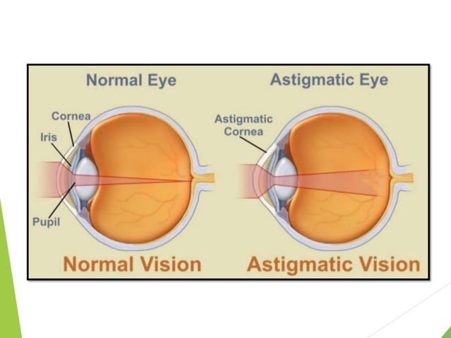 Human Eye Presentation.pdf