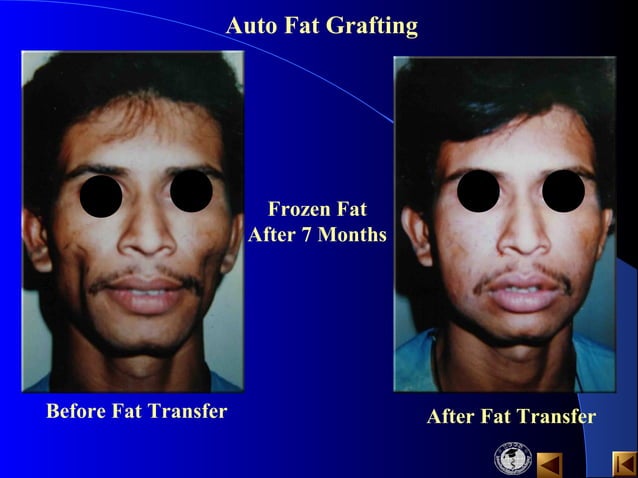 Human fat tissue bank | PPT