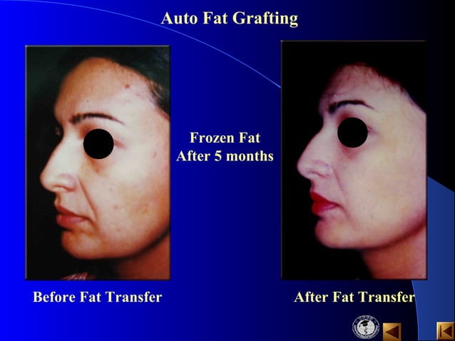 Human fat tissue bank | PPT