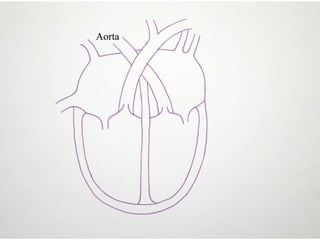 Reptile Heart Diagram